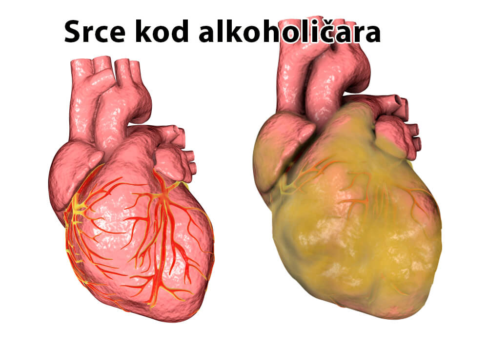 The effects of alcohol consumption, treatment at the clinic || Dr Vorobjev